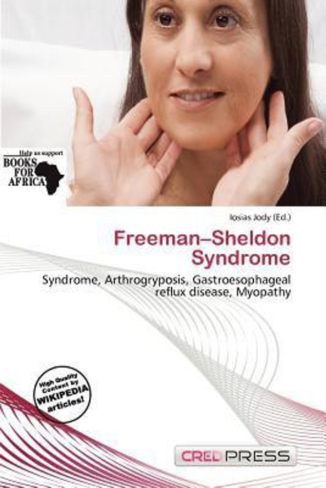 Freeman Sheldon Syndrome