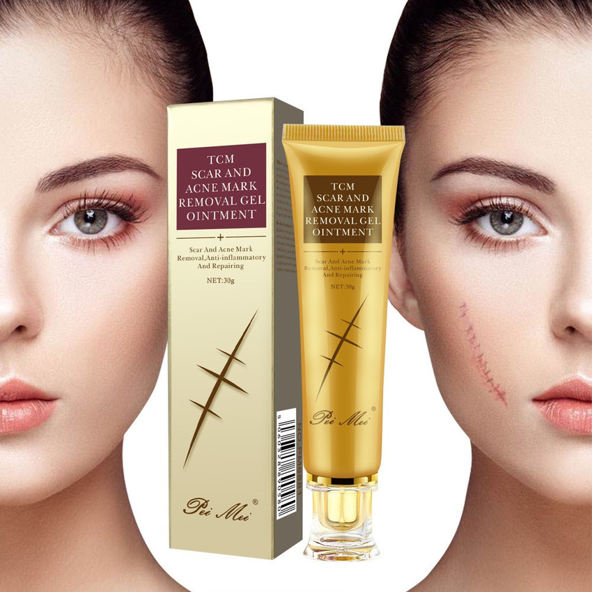 Face mark removal cream store