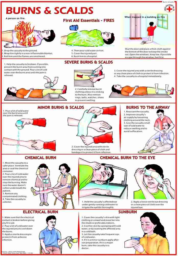 Chemical Burn First Aid