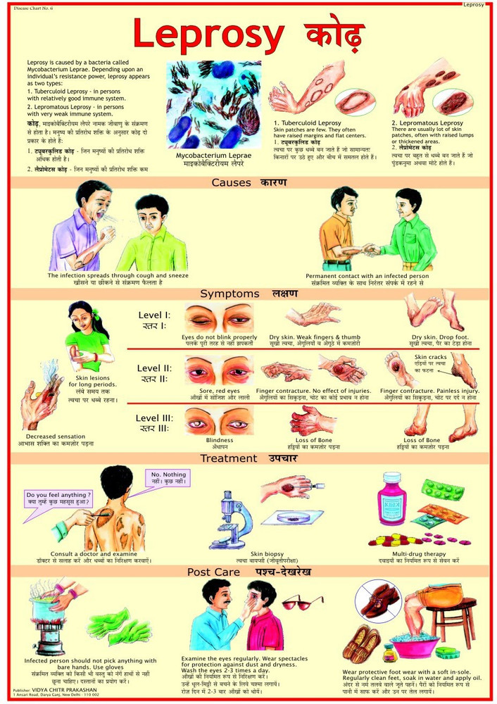 Leprosy Prevention