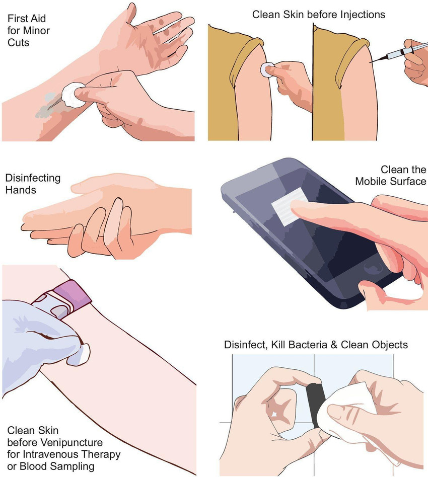 What is alcohol swab store