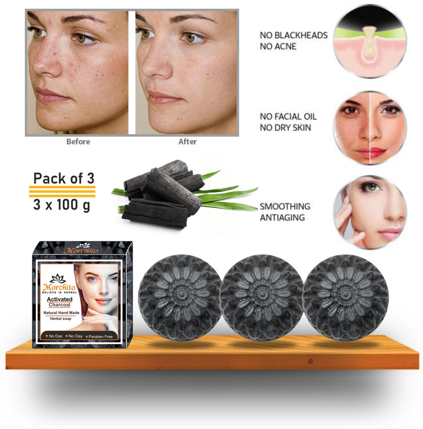 Charcoal soap for acne store