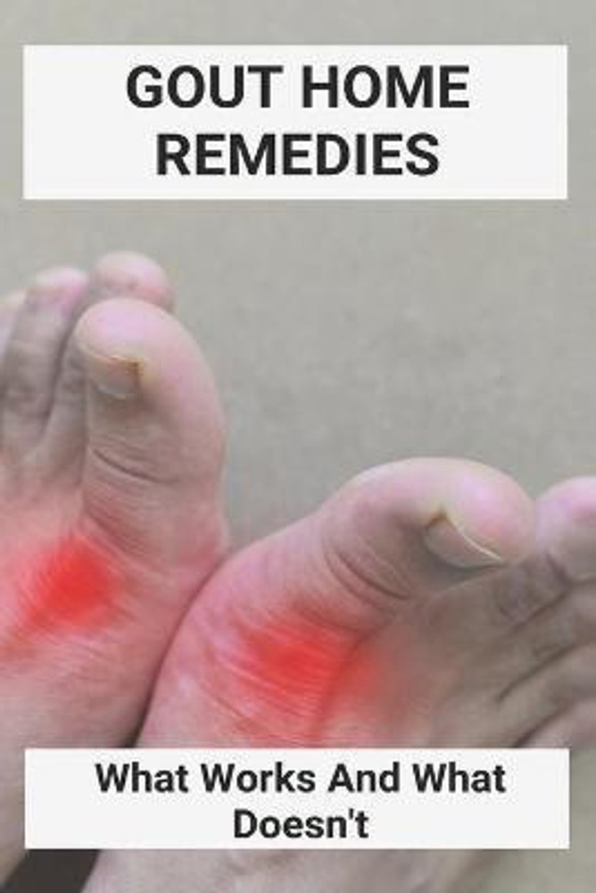 Home Remedies For Gout On Foot Sale Online | emergencydentistry.com