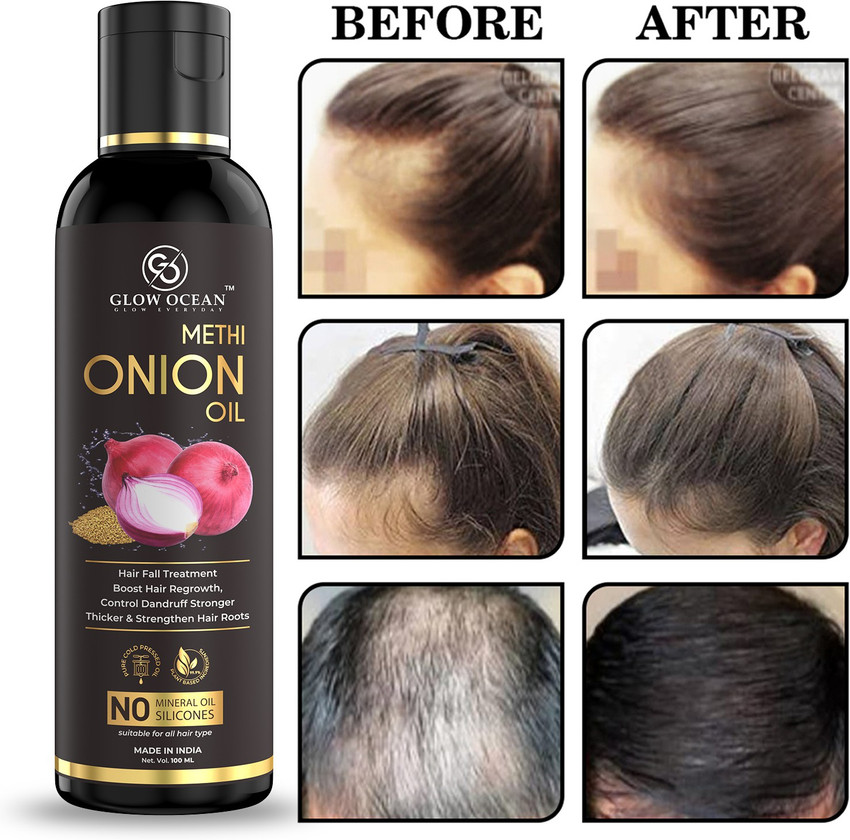 glowocean Onion Methi Hair oil For Hair Fall Control Hair Growth Hair Regrowth Hair Oil Price in India Buy glowocean Onion Methi Hair oil For Hair Fall Control Hair Growth