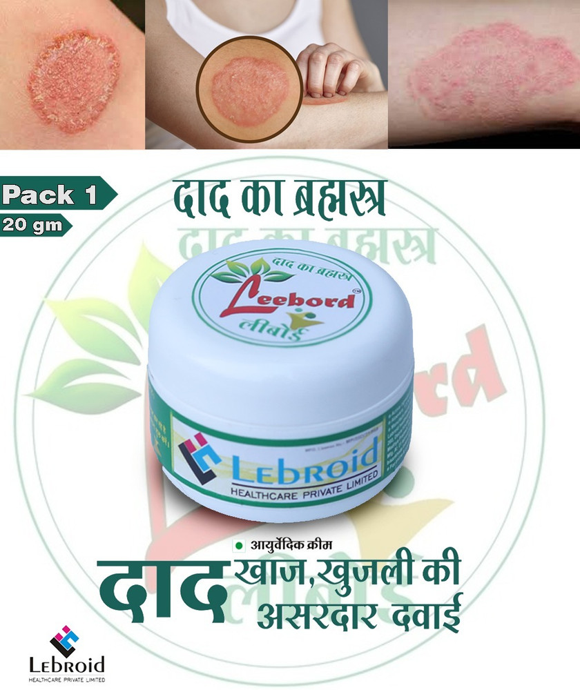 Ringworm Rash Treatment Cream How To Get Rid Of Ringworm: 7 Treatments
