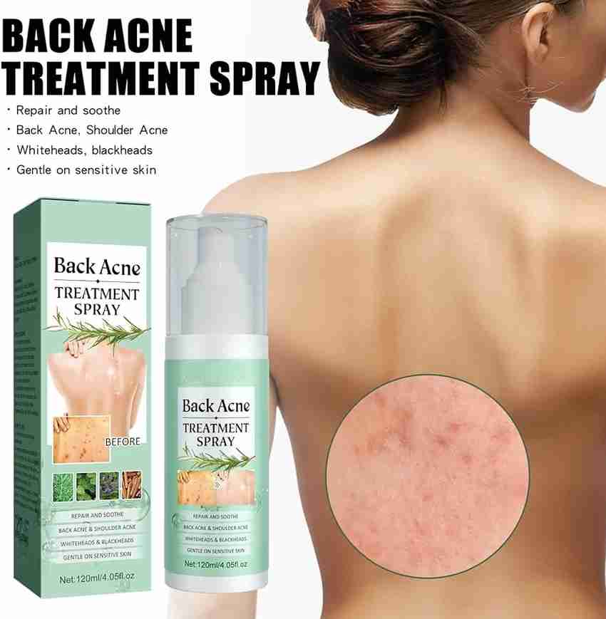 Prefetto COSMO 100 ORIGINAL Back Acne Treatment Spray Price in India Buy Prefetto COSMO 100 ORIGINAL Back Acne Treatment Spray online at Flipkart