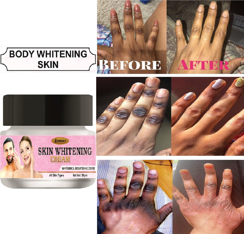 Rosevely Strong Full Body Skin Whitening Day Night Cream for Men Women Price in India Buy Rosevely Strong Full Body Skin Whitening Day Night Cream for Men
