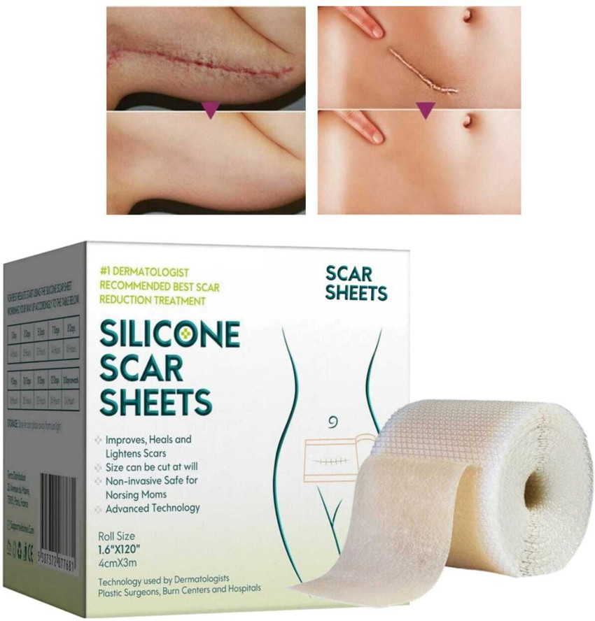 Dr. NAvadiya Medical Silicone Scar Tape Roll Soft Silicone Tape for Scars Removal Price in India Buy Dr. NAvadiya Medical Silicone Scar Tape Roll Soft Silicone Tape for Scars