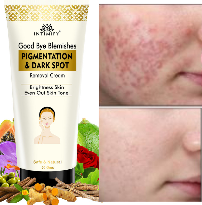 Spot cream for face store