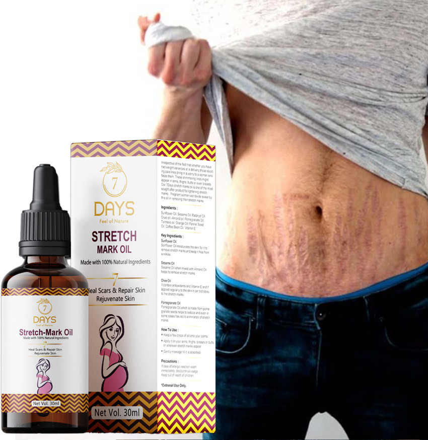 Stretch Marks Men Removal