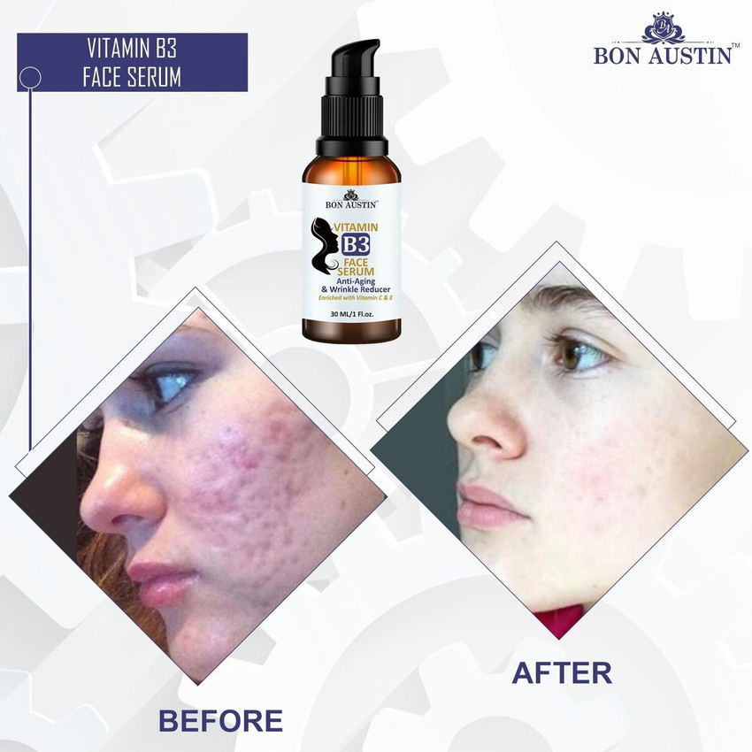 Vitamin b3 for skin store