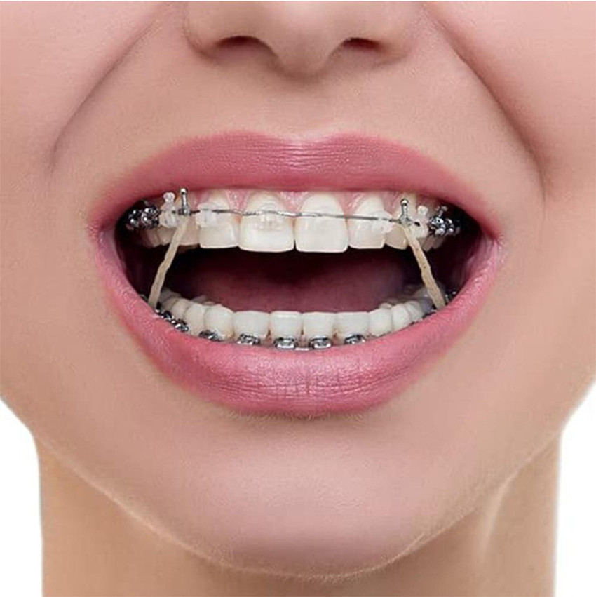 Buy orthodontic rubber bands store
