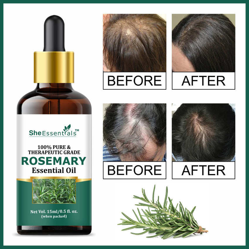Rosemary oil for hair loss store