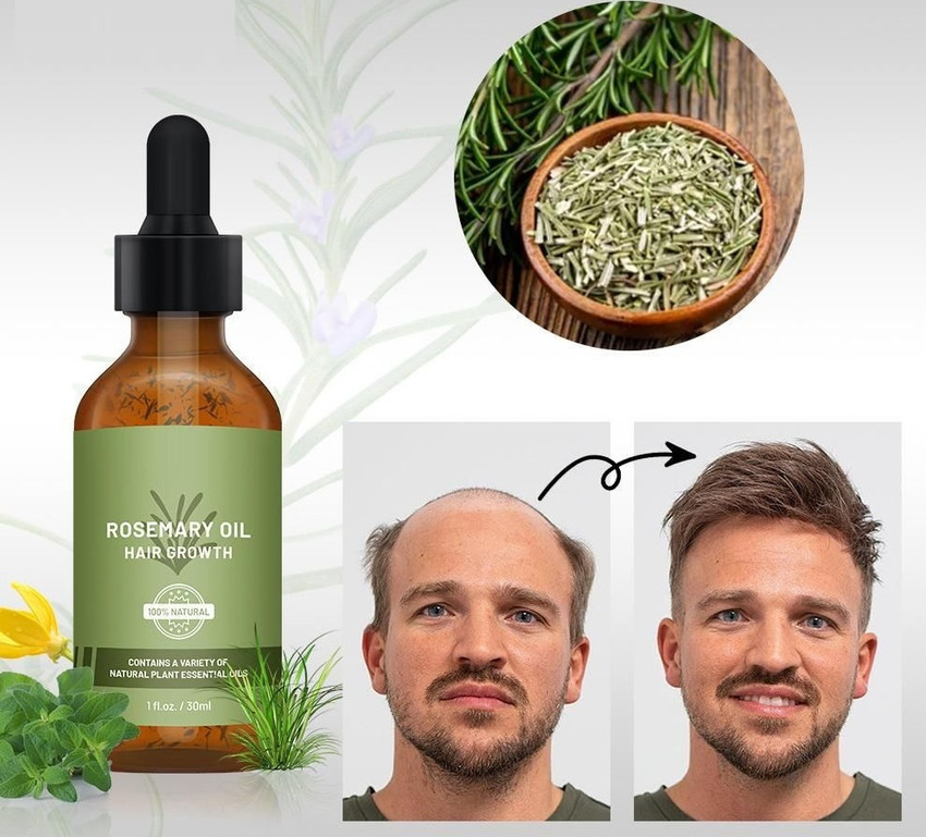 Rosemary oil for hair growth store
