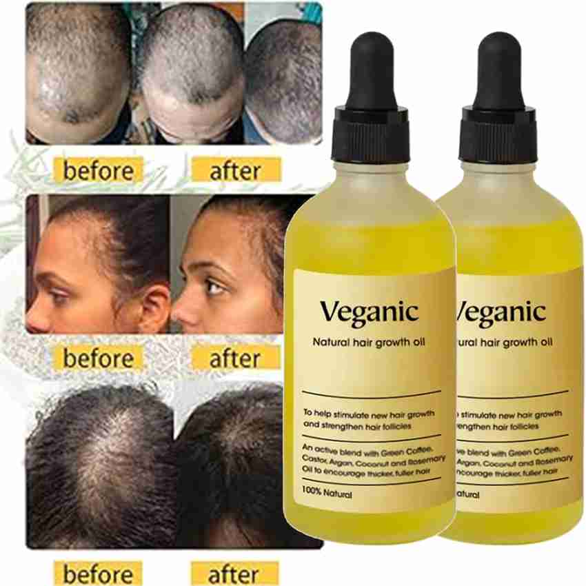 Natural hair oil for hair growth store
