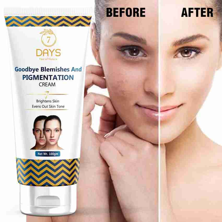 7 Days Pigmentation removal cream for women Acne Scar Removal Dark Spots Stretch Marks Price in India Buy 7 Days Pigmentation removal cream for women Acne Scar Removal Dark Spots Stretch