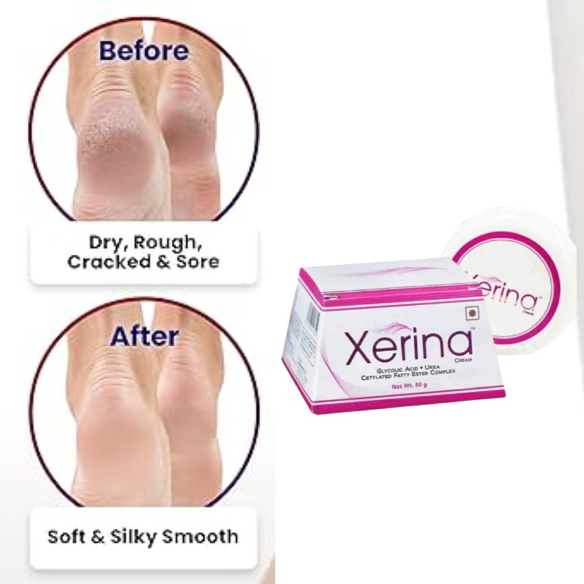XERINA Cream Pack of 1 Price in India Buy XERINA Cream Pack of 1 online at Flipkart
