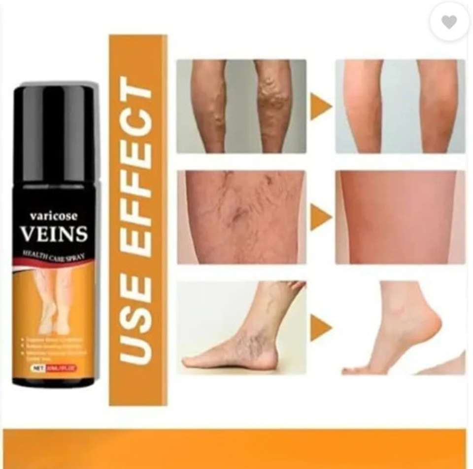 BIFRRUTANT Varicose veins oil herbal veins spray herbal blend for blood ...