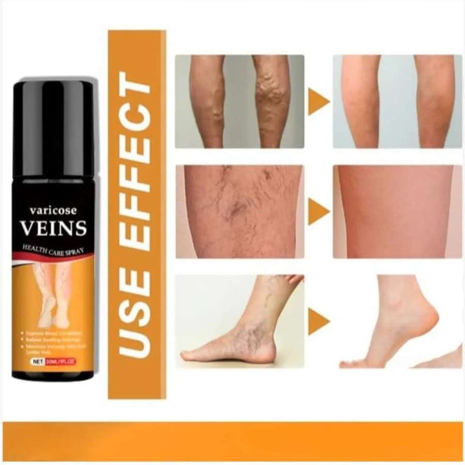 BIFRRUTANT Varicose Vein Spray with Herbal Formula for Calves Quick ...