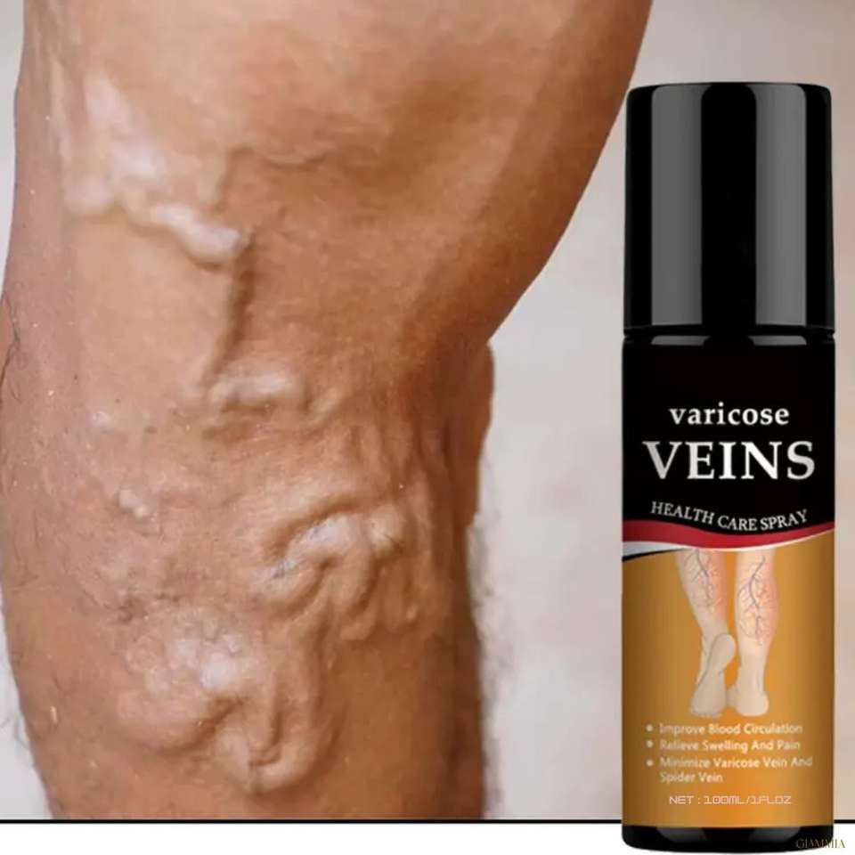 CHIWA Herbal Varicose Vein Spray - Reduces Stress On Weak Veins Spray ...