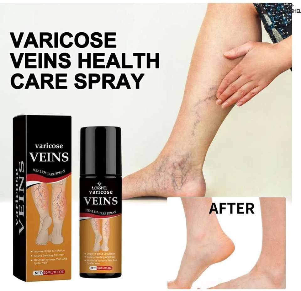 LORSHEL vericose vein spray instant soothing formula for tired heavy ...