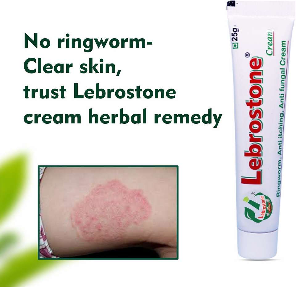 Lebrostone Ayurvedic Skin Care Treatment Cream 25g – For Ringworm ...