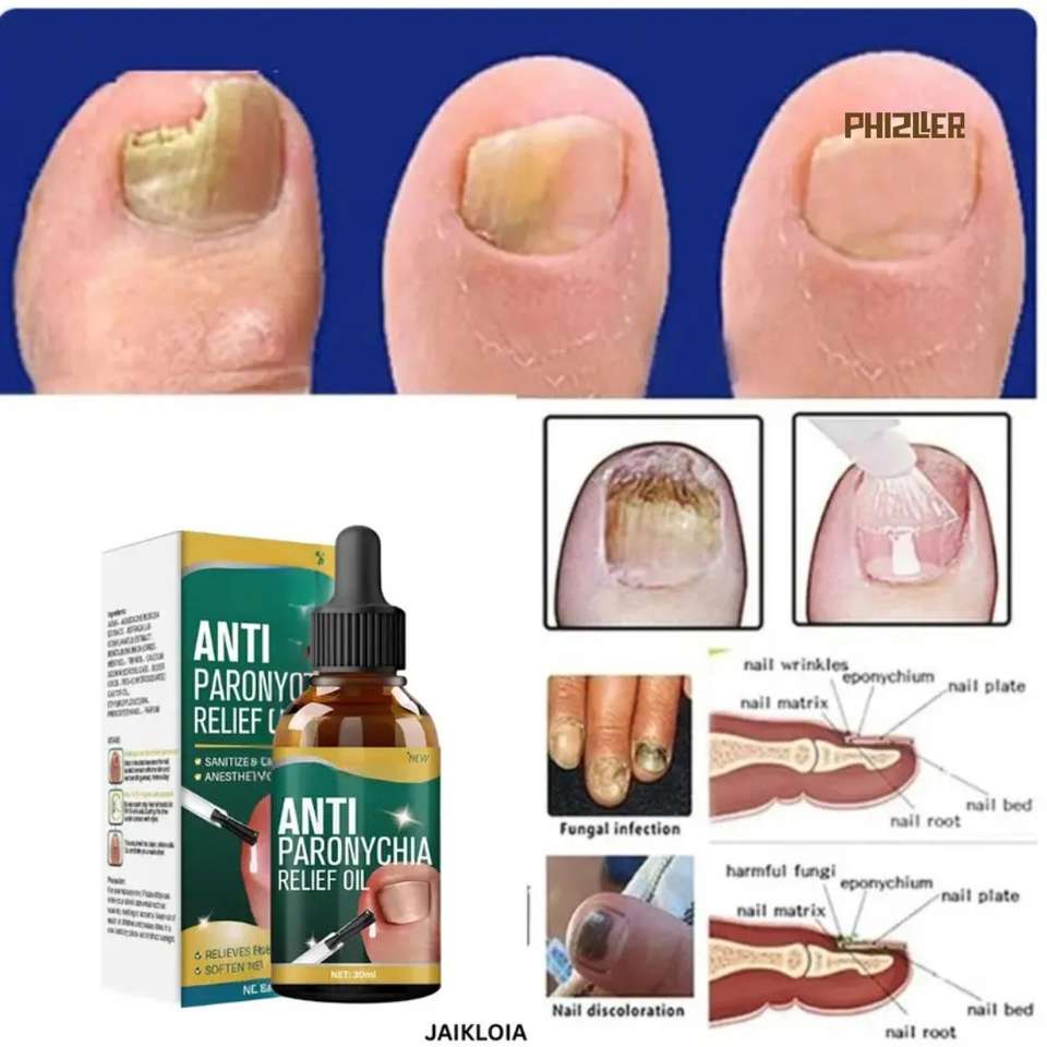 PHIZLLER Anti Paronychia Relief Oil Nail Protection Oil Price in India ...
