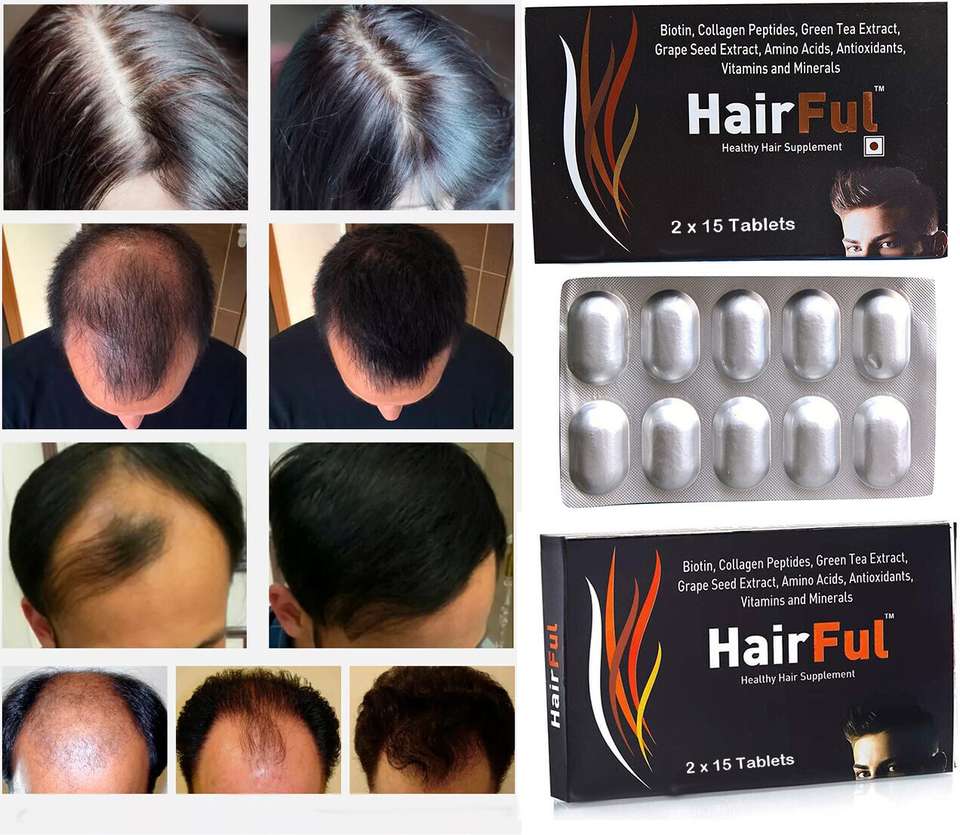 HairFul Biotin Hair Regrowth & Hair Fall Tablets 30 Price in India ...