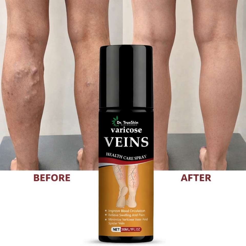 Dr.trueskin Vericose Veins Spray for Gentle Cool Relax Leg Mist Spray ...